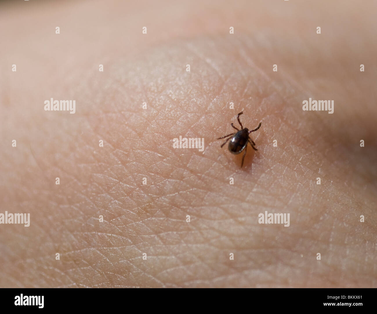 Tick rampant sur la peau humaine Photo Stock - Alamy