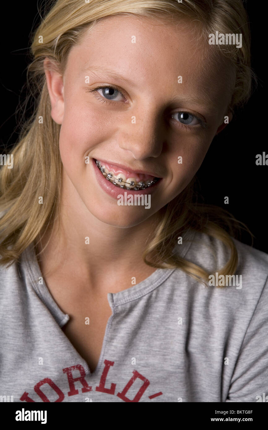 Girl With Braces Banque De Photographies Et Dimages à Haute Résolution