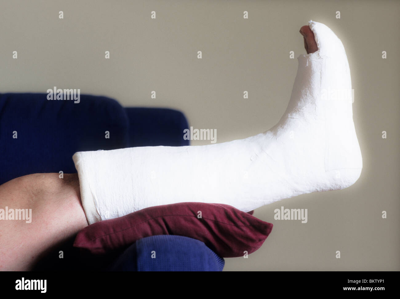 Jambe Dans Le Plâtre Banque De Photographies Et Dimages à Haute