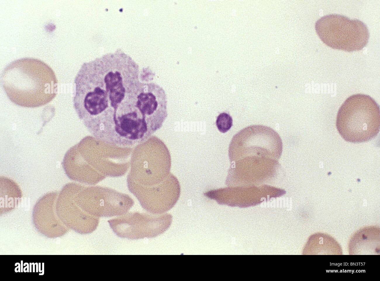 Frottis sang normal Banque de photographies et d’images à haute ...