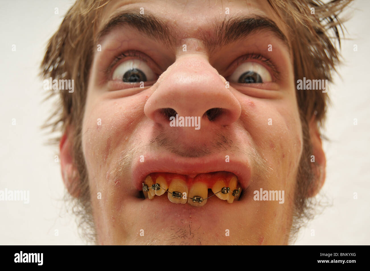 Dents de travers Banque de photographies et d’images à haute résolution ...