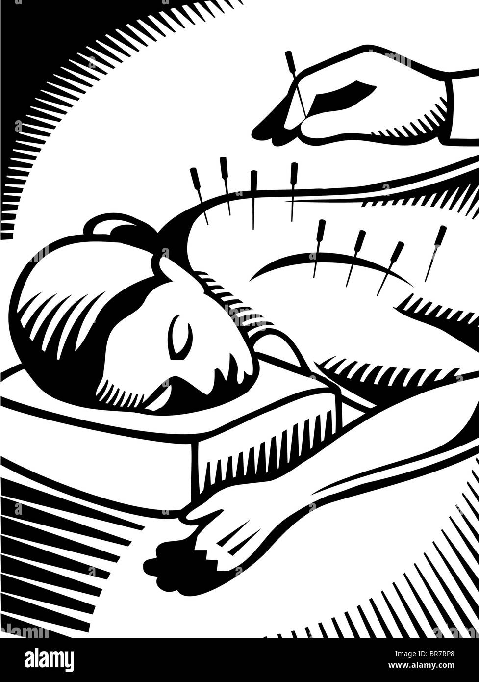 Dessin humoristique acupuncture Banque d'images noir et blanc - Alamy