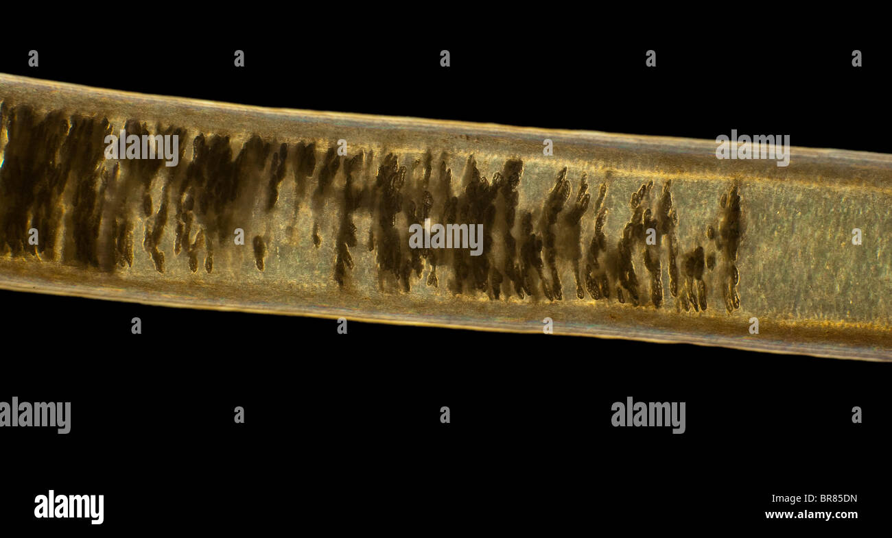 Microscope peau epiderme trichologie champ sombre photomicrographie de ...