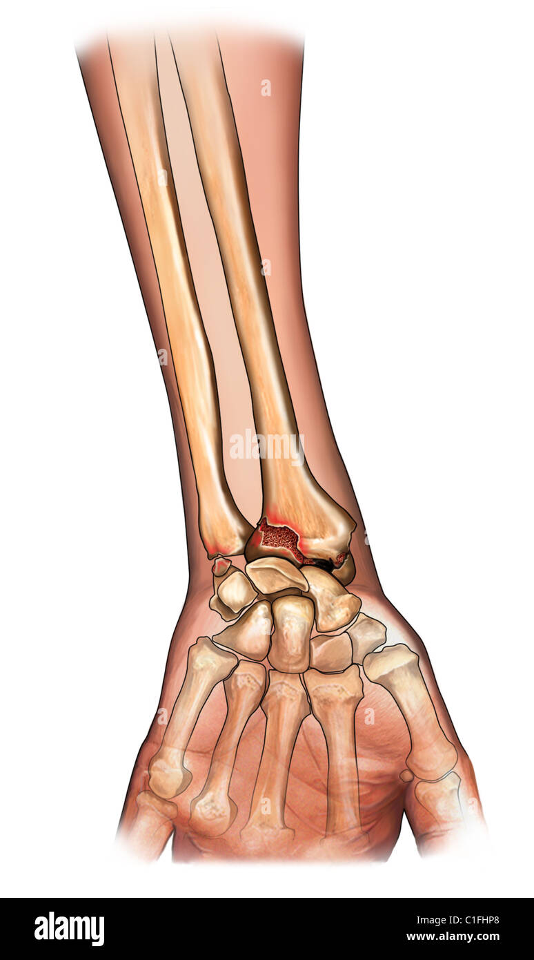 Os du poignet vue palmaire Banque de photographies et d’images à haute ...