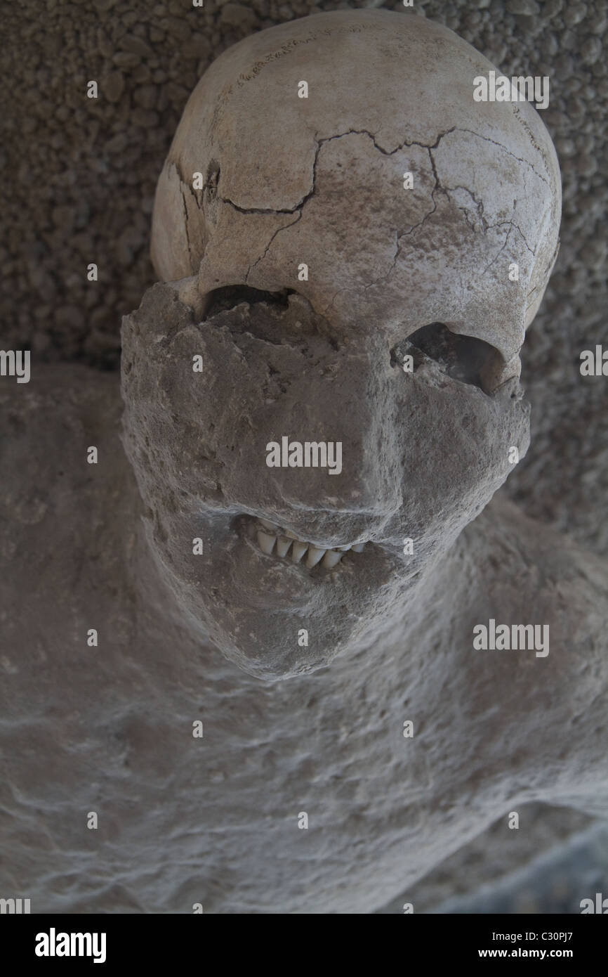 Cadavre humain Banque de photographies et d’images à haute résolution ...