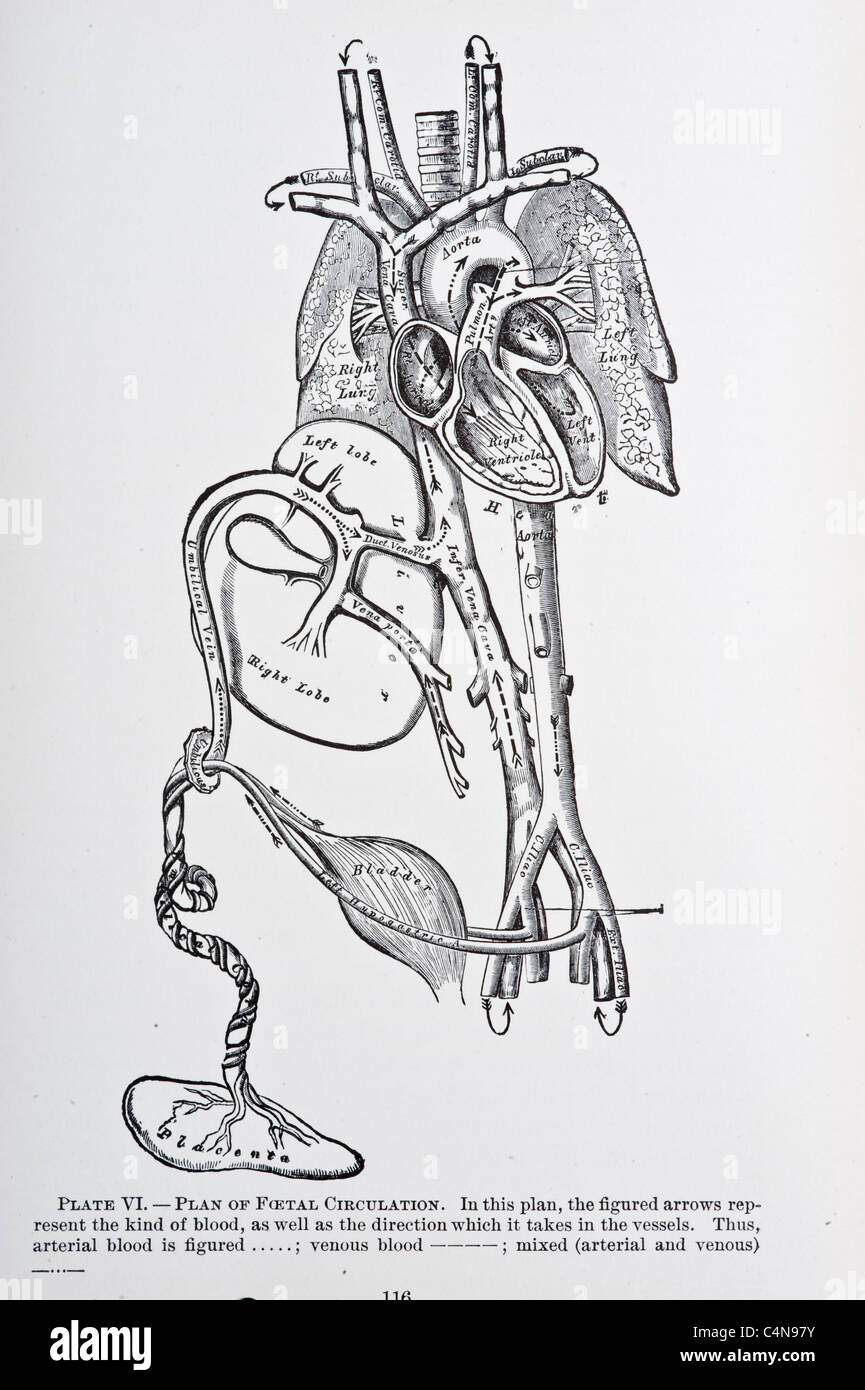 Années 1800, autopsie d'anatomie corps humain médecine chirurgie ...