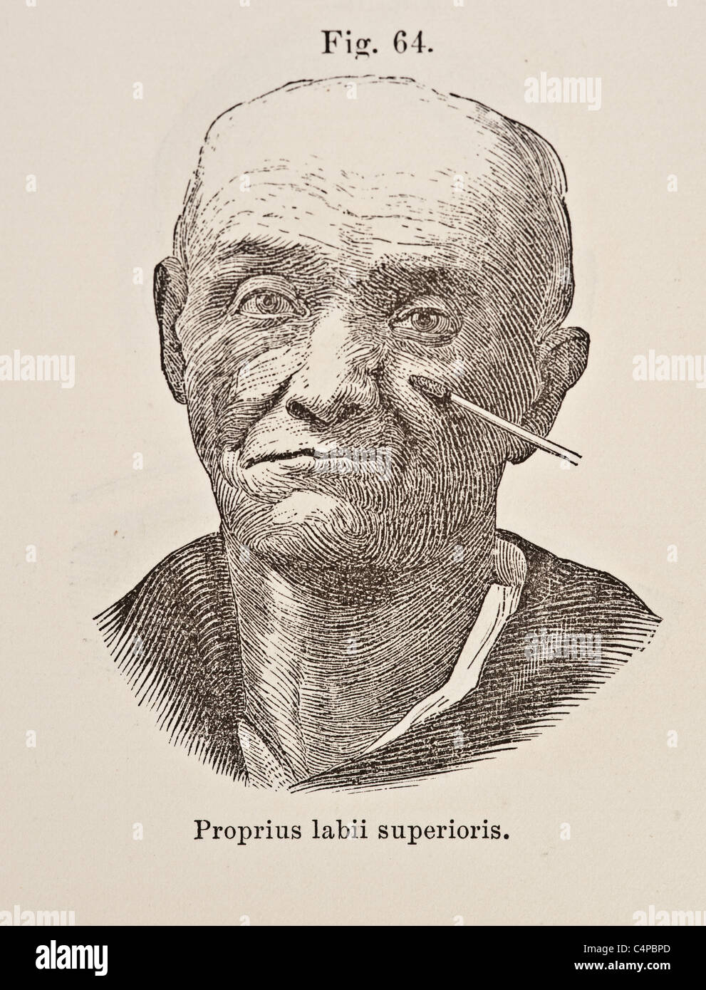 Labii Superioris Illustration de Proprius circa 1881 Photo Stock - Alamy