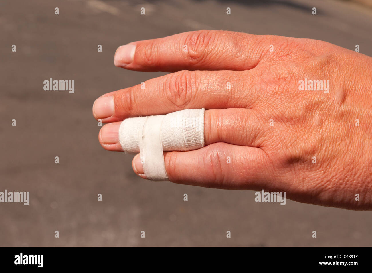 Doigt cassé Banque de photographies et d’images à haute résolution - Alamy