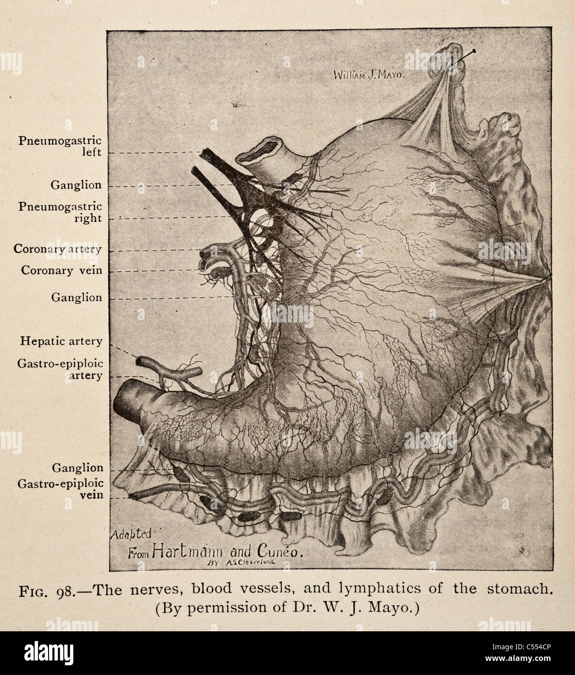 Illustration médicale antique d'une dissection de l'estomac humain ...