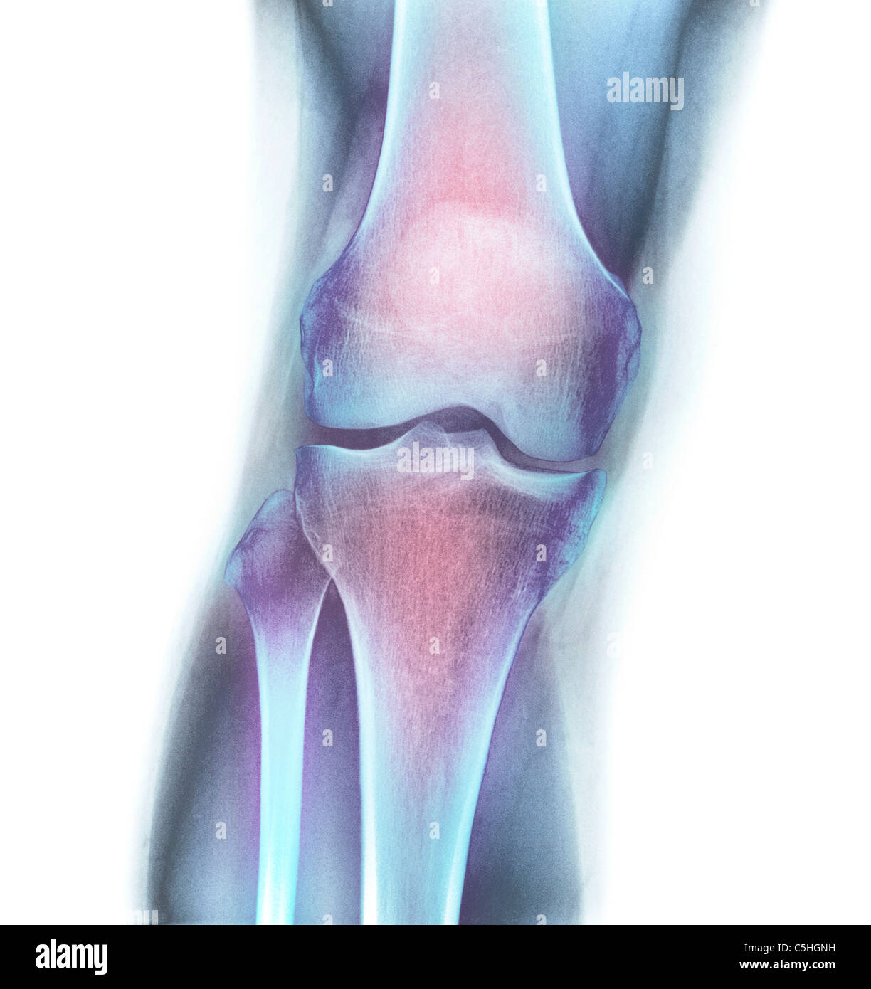 Normal knees Banque de photographies et d’images à haute résolution - Alamy