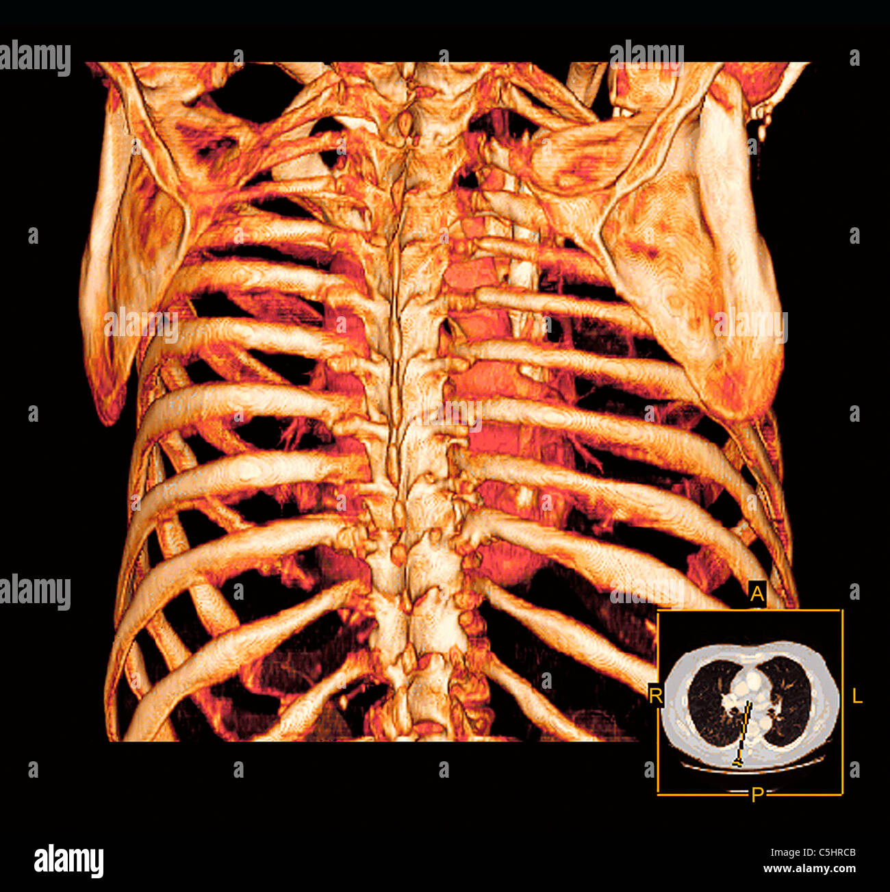 Ct scan abdomen 3d Banque de photographies et d’images à haute ...