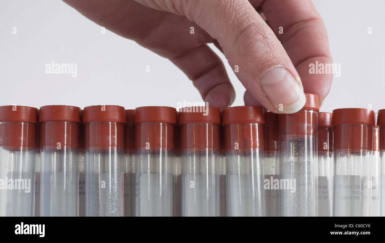 Main d'un technicien de laboratoire prend un tube de prélèvement de ...