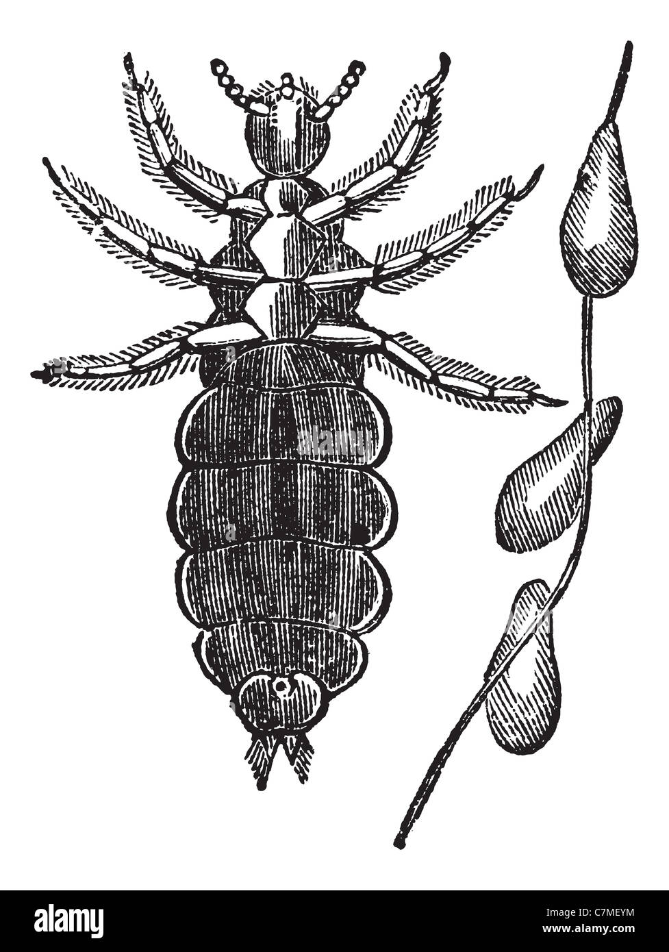 Les poux de tête ou des poux de tête, gravure d'époque. Vieille ...