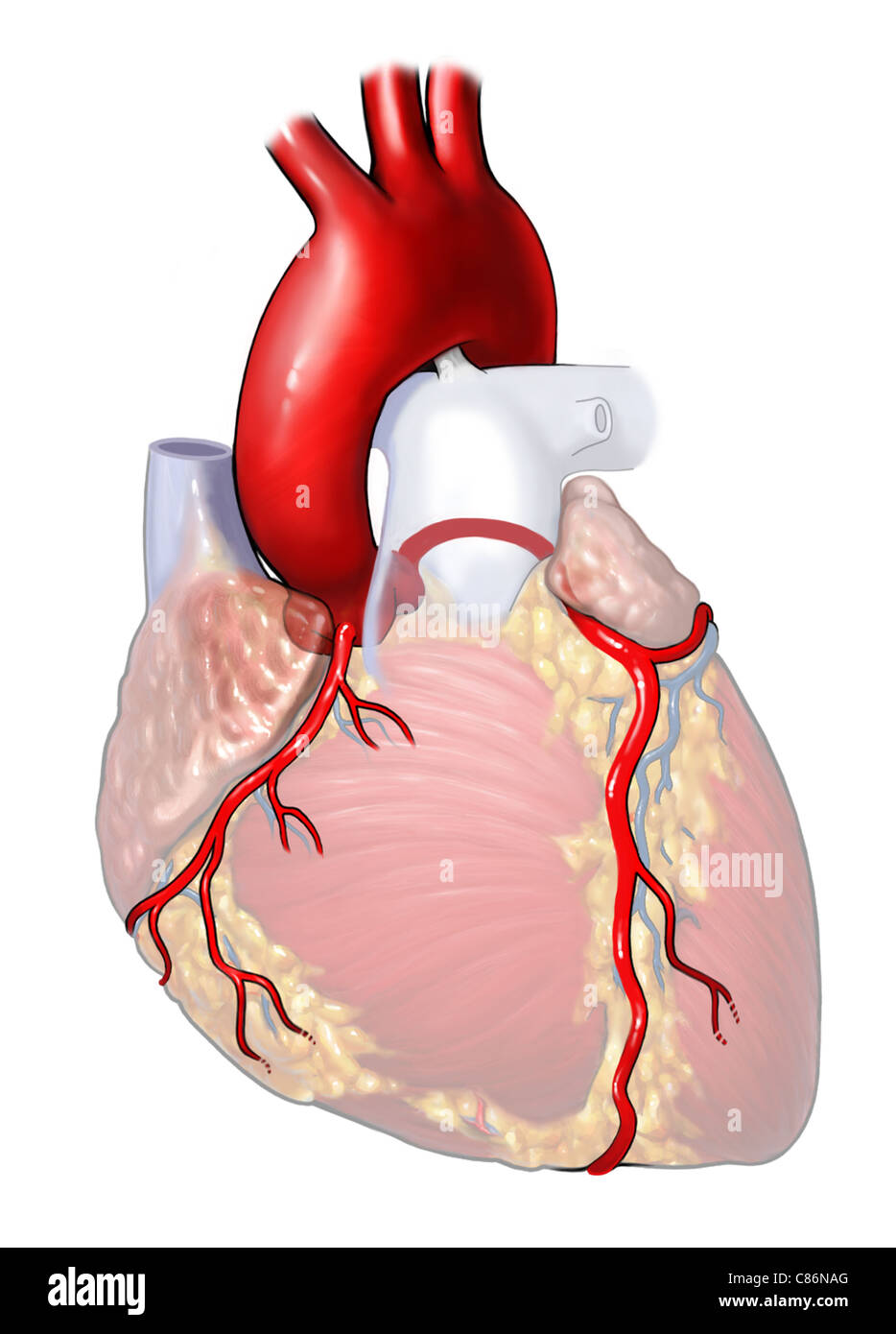 Sténose Aortique Banque d'image et photos - Alamy