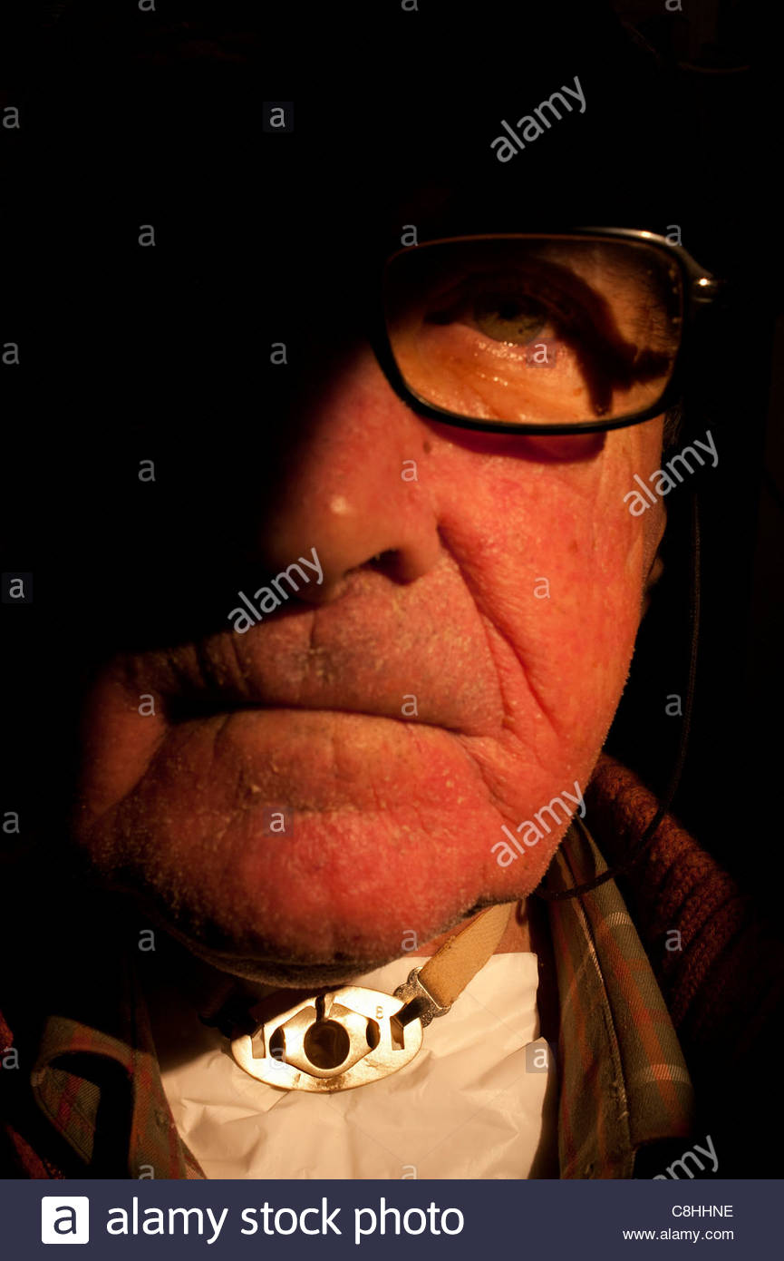 Cancer De La Gorge Banque d'image et photos - Alamy