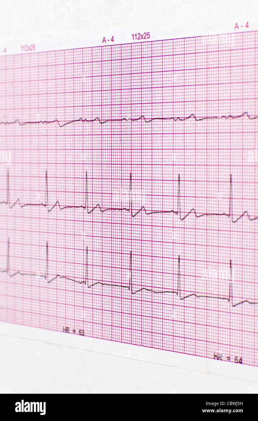 Ecg impression Banque de photographies et d’images à haute résolution ...