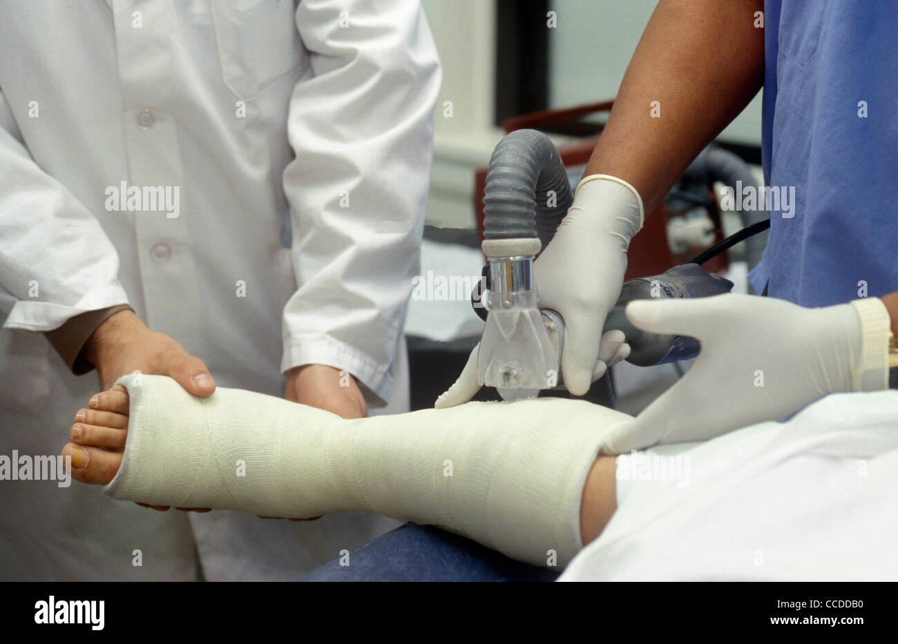 Les médecins orthopédiques déposer un moulage à partir d'un patient ...