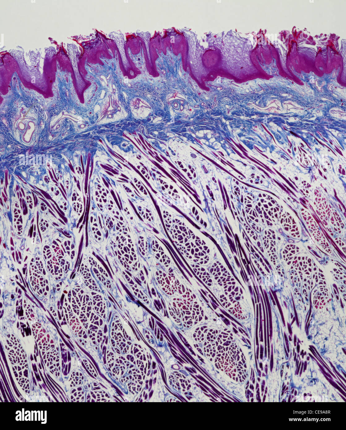 Papillae tongue Banque de photographies et d’images à haute résolution ...