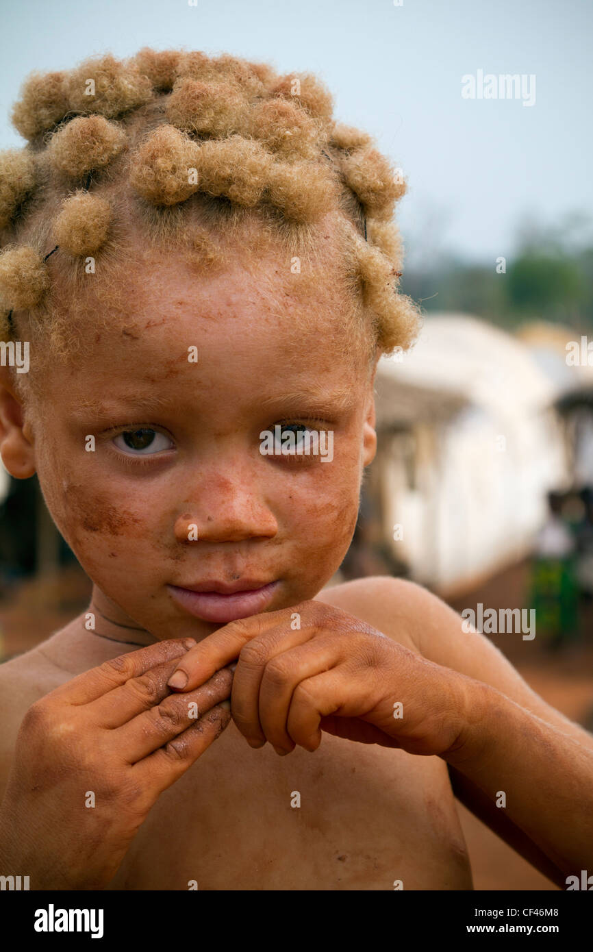 Albino child Banque de photographies et d’images à haute résolution - Alamy
