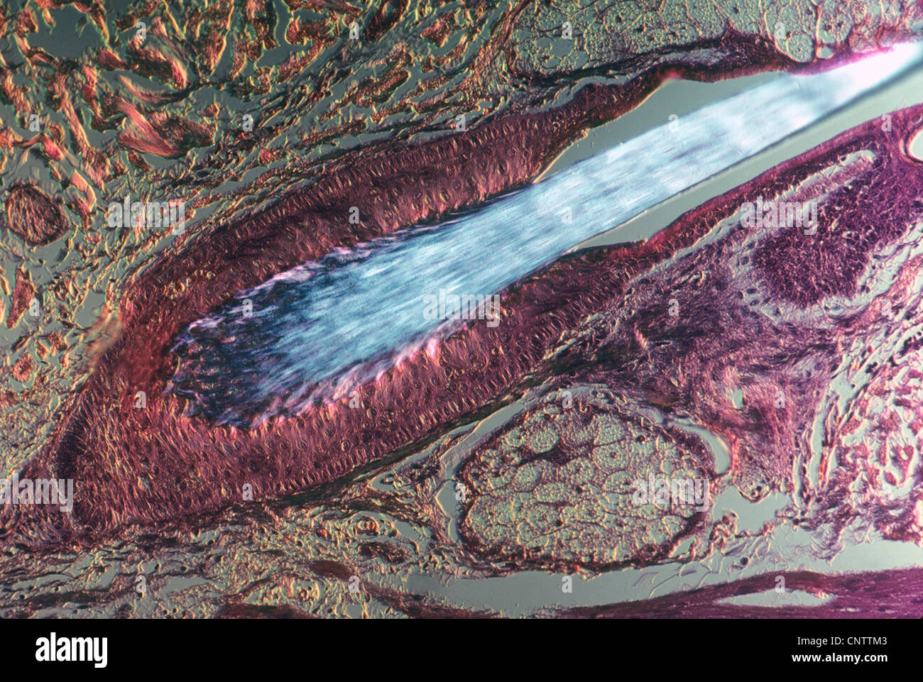 Glande Sébacée Humaine Banque d'image et photos - Alamy