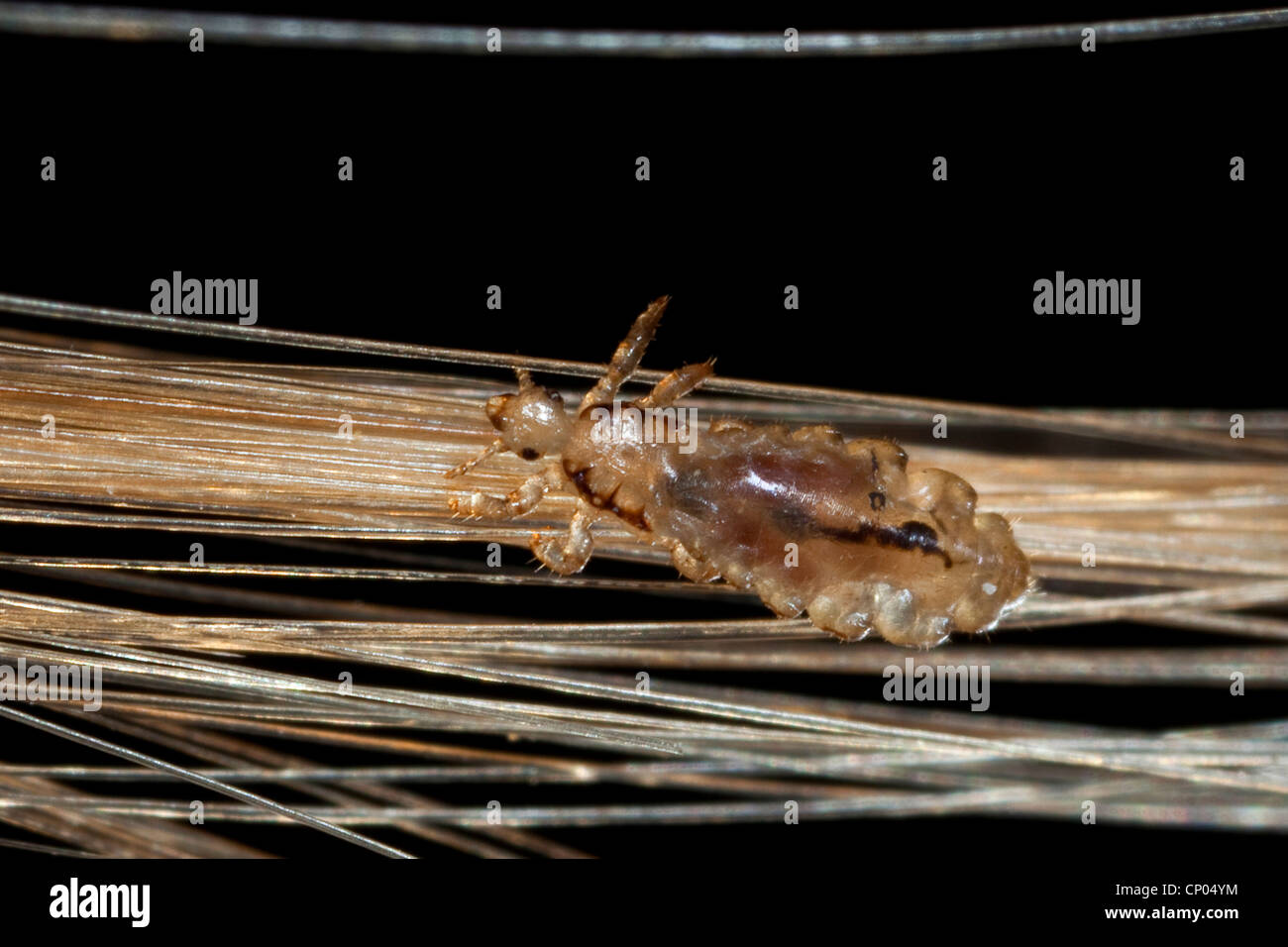 Poux de tête (Pediculus capitis, ou Pediculus humanus capitis, ou ...