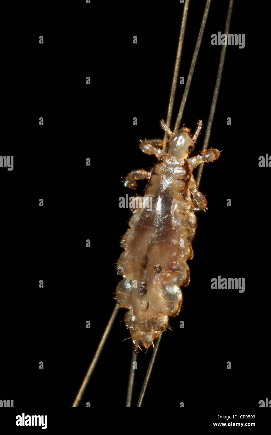 Poux de tête (Pediculus capitis, ou Pediculus humanus capitis, ou ...