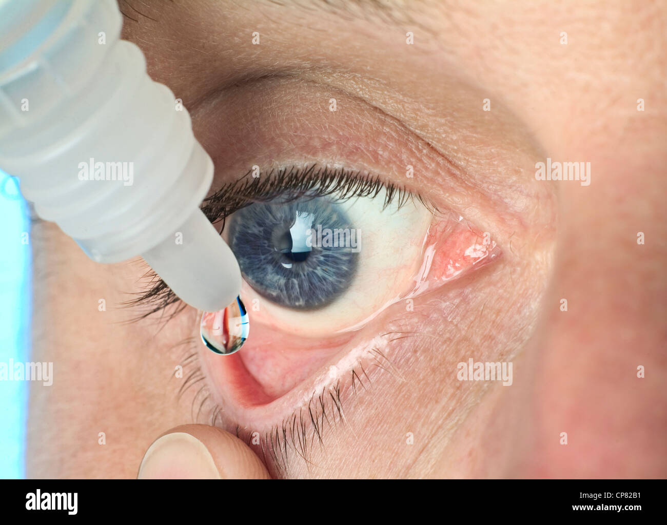 Allergie Au Pollen Yeux Banque d'image et photos - Alamy