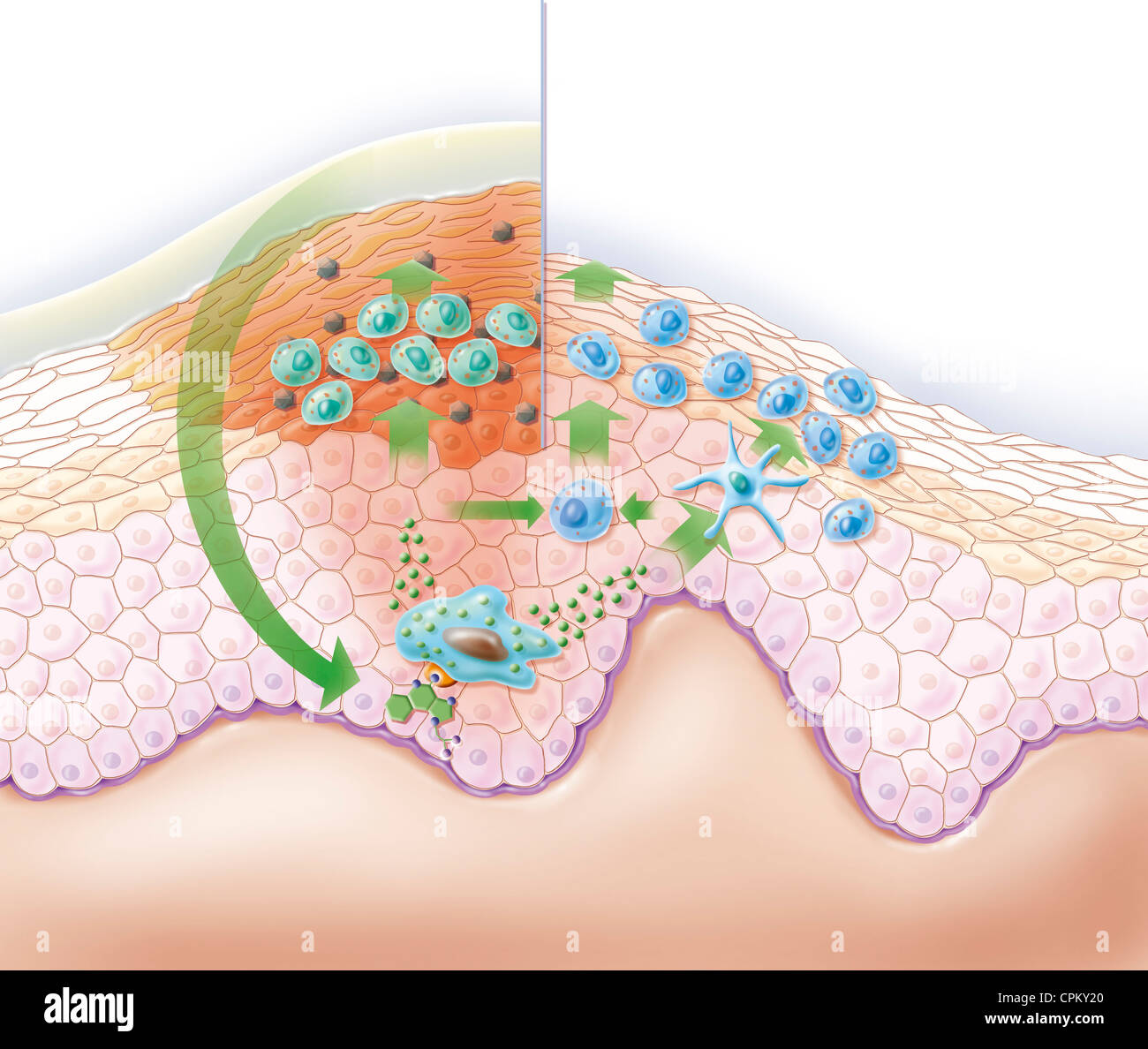 Verrues génitales Banque de photographies et d’images à haute ...