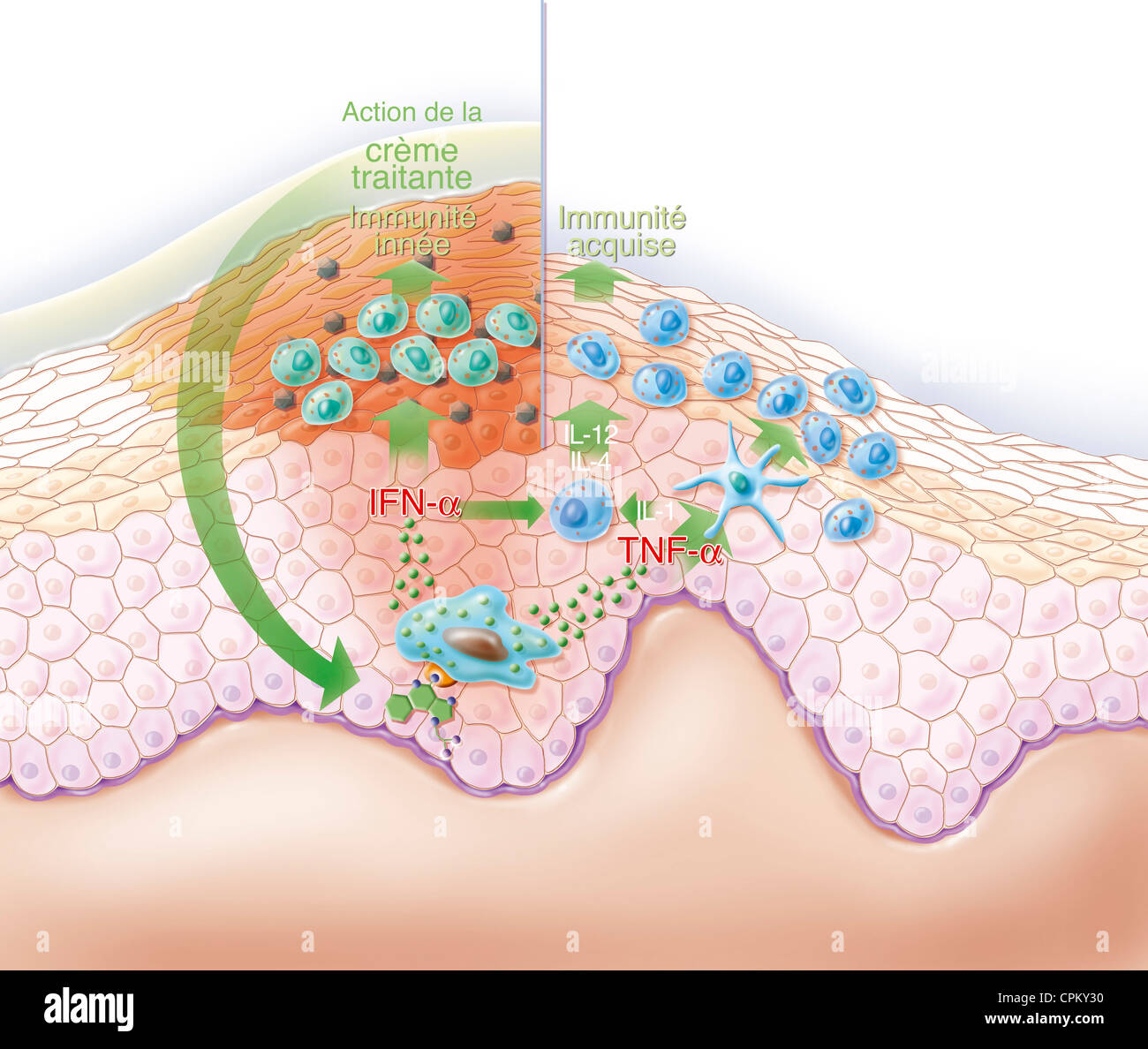 Verrues génitales Banque de photographies et d’images à haute ...
