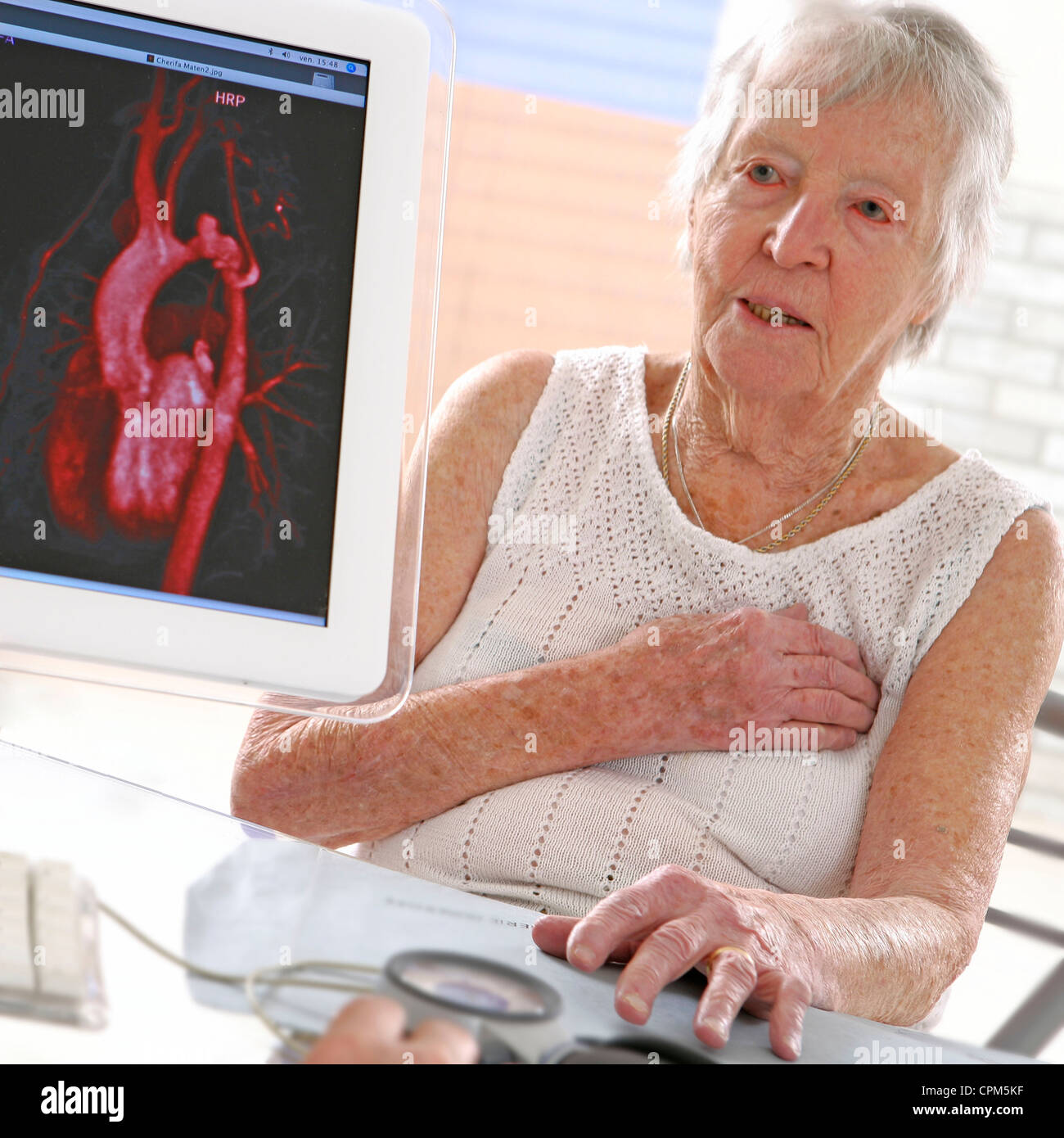 Vascularisation du coeur Banque de photographies et d’images à haute ...