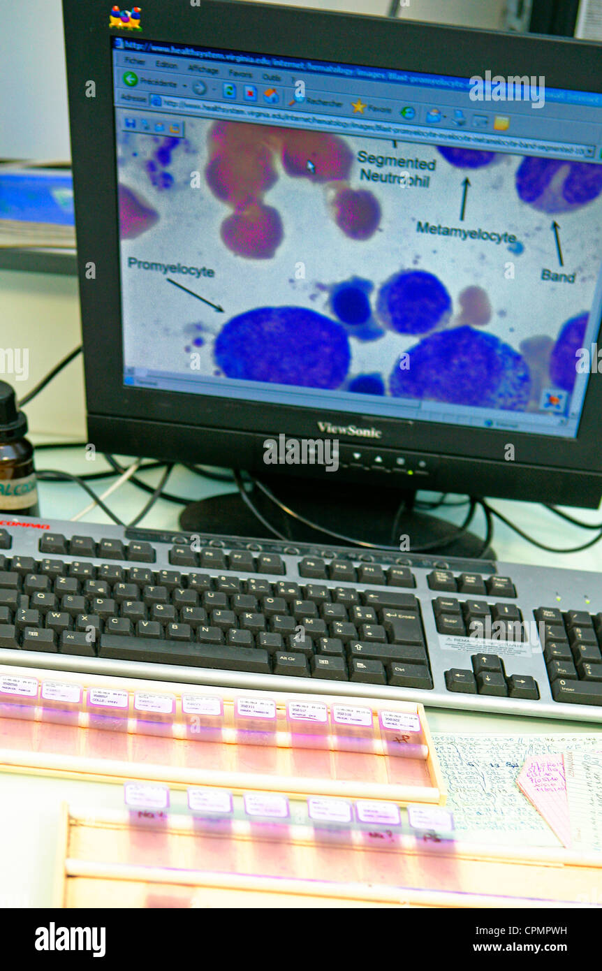 Frotti sanguin Banque de photographies et d’images à haute résolution ...