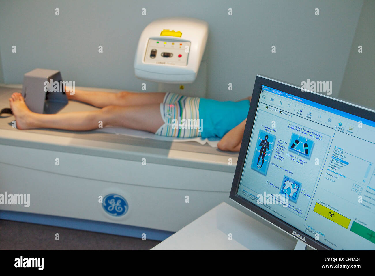 La densitométrie osseuse Banque de photographies et d’images à haute ...