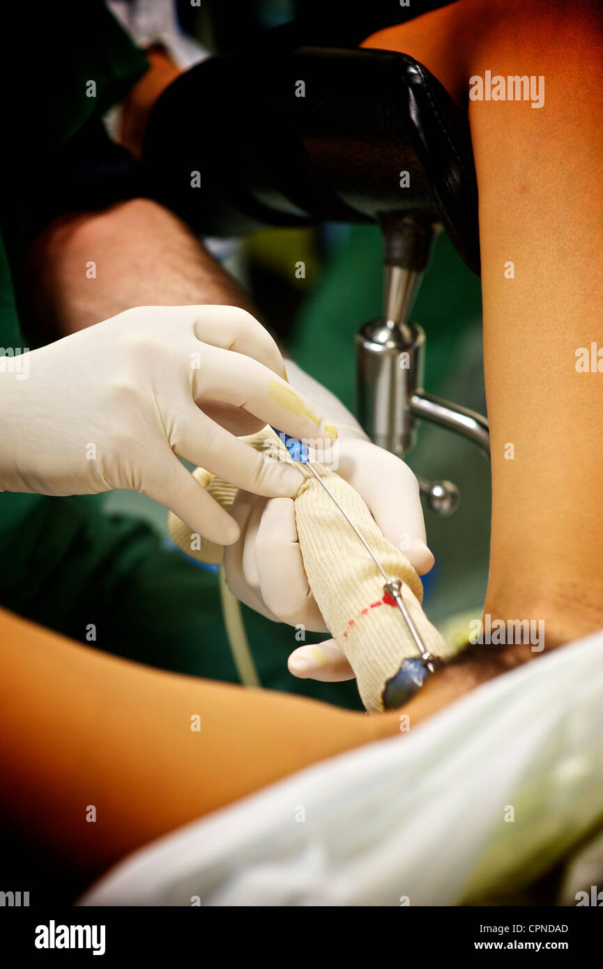 Follicular puncture Banque de photographies et d’images à haute ...