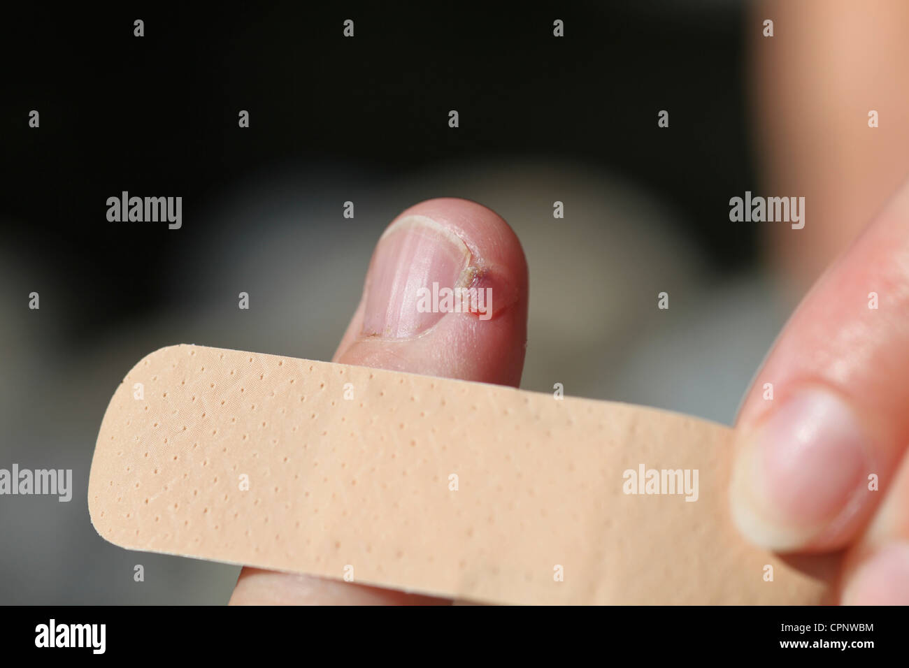 Open wound Banque de photographies et d’images à haute résolution - Alamy