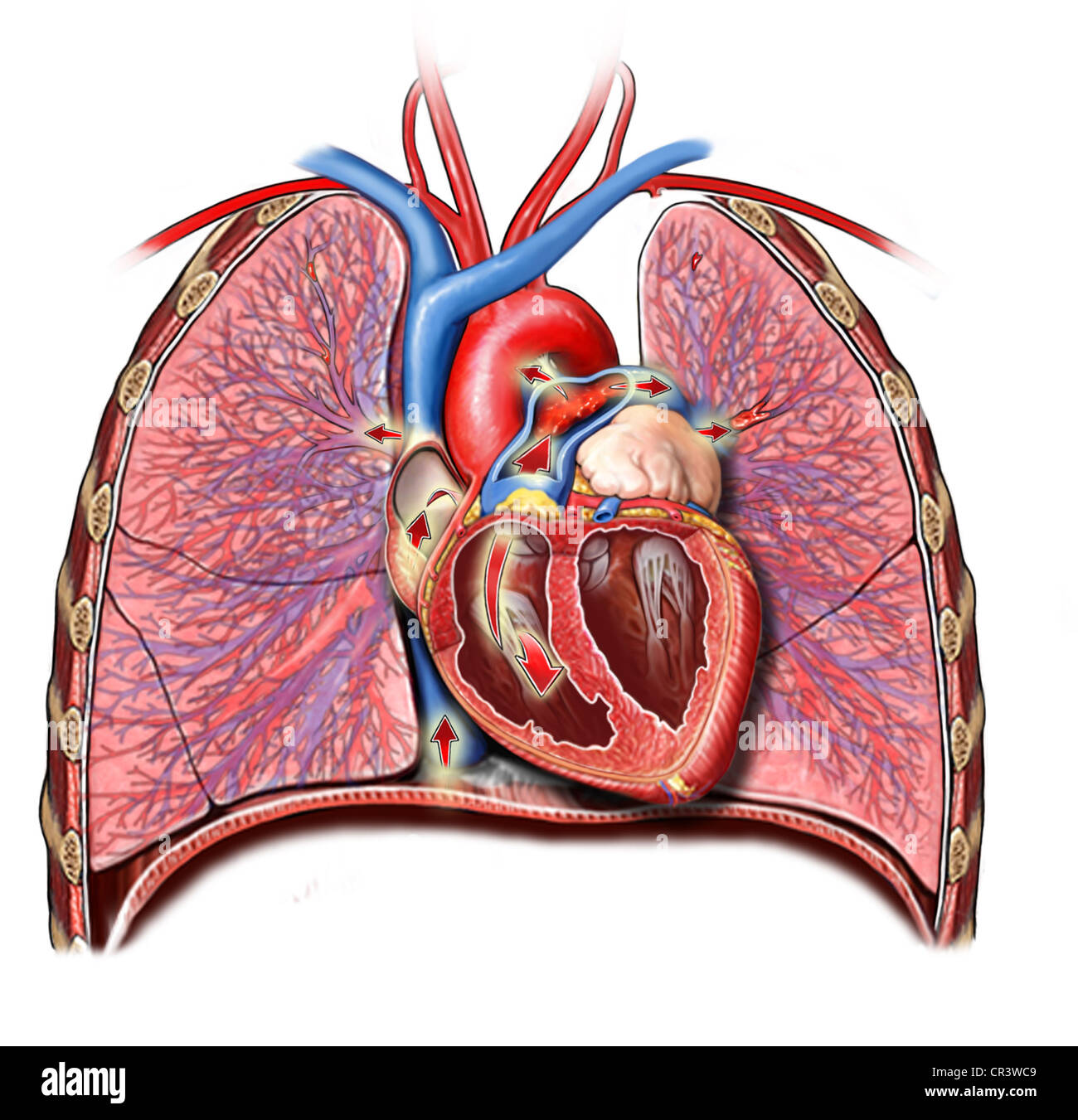 Embolie pulmonaire Banque de photographies et d’images à haute ...