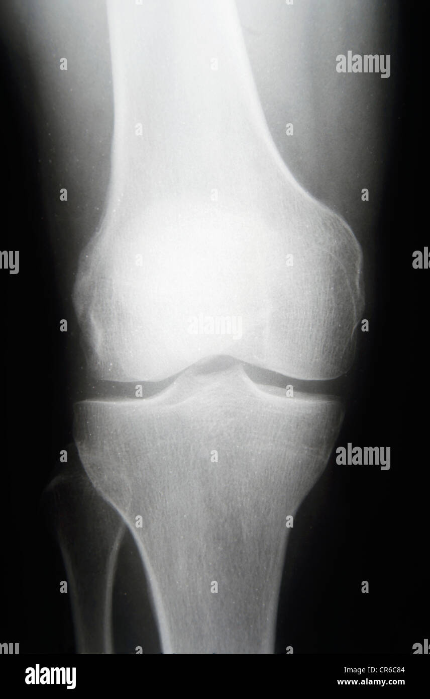 Anatomie Du Genou Banque d'image et photos - Alamy