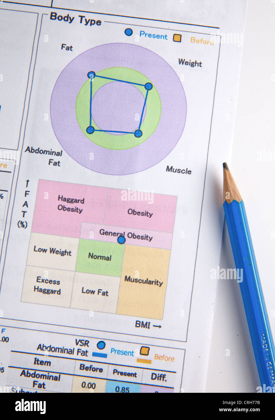 Analyse de la composition corporelle Banque de photographies et d ...