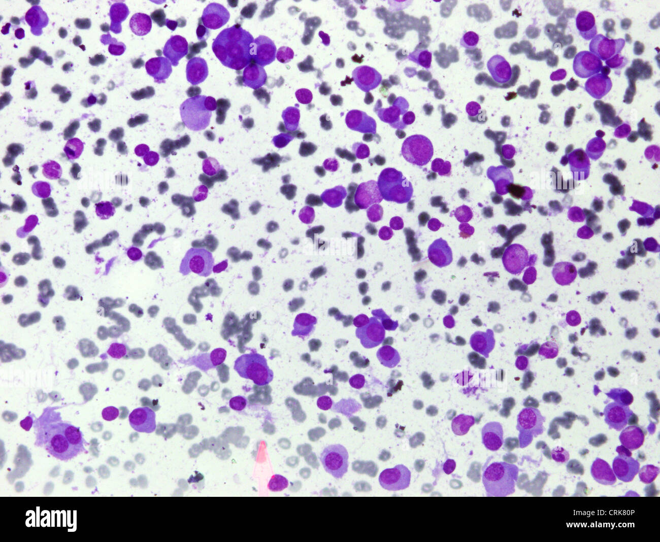 Microscope Et Cellules Sanguines Banque d'image et photos - Page 2 - Alamy