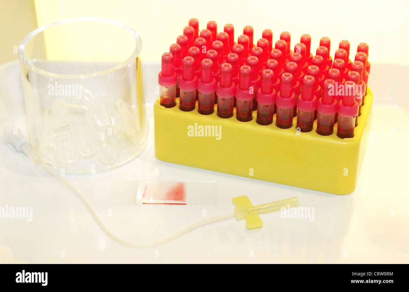 Frottis sanguin coloré Banque de photographies et d’images à haute ...