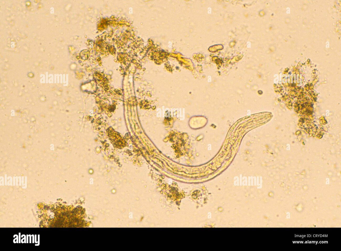 Ancylostoma sp Banque de photographies et d’images à haute résolution ...