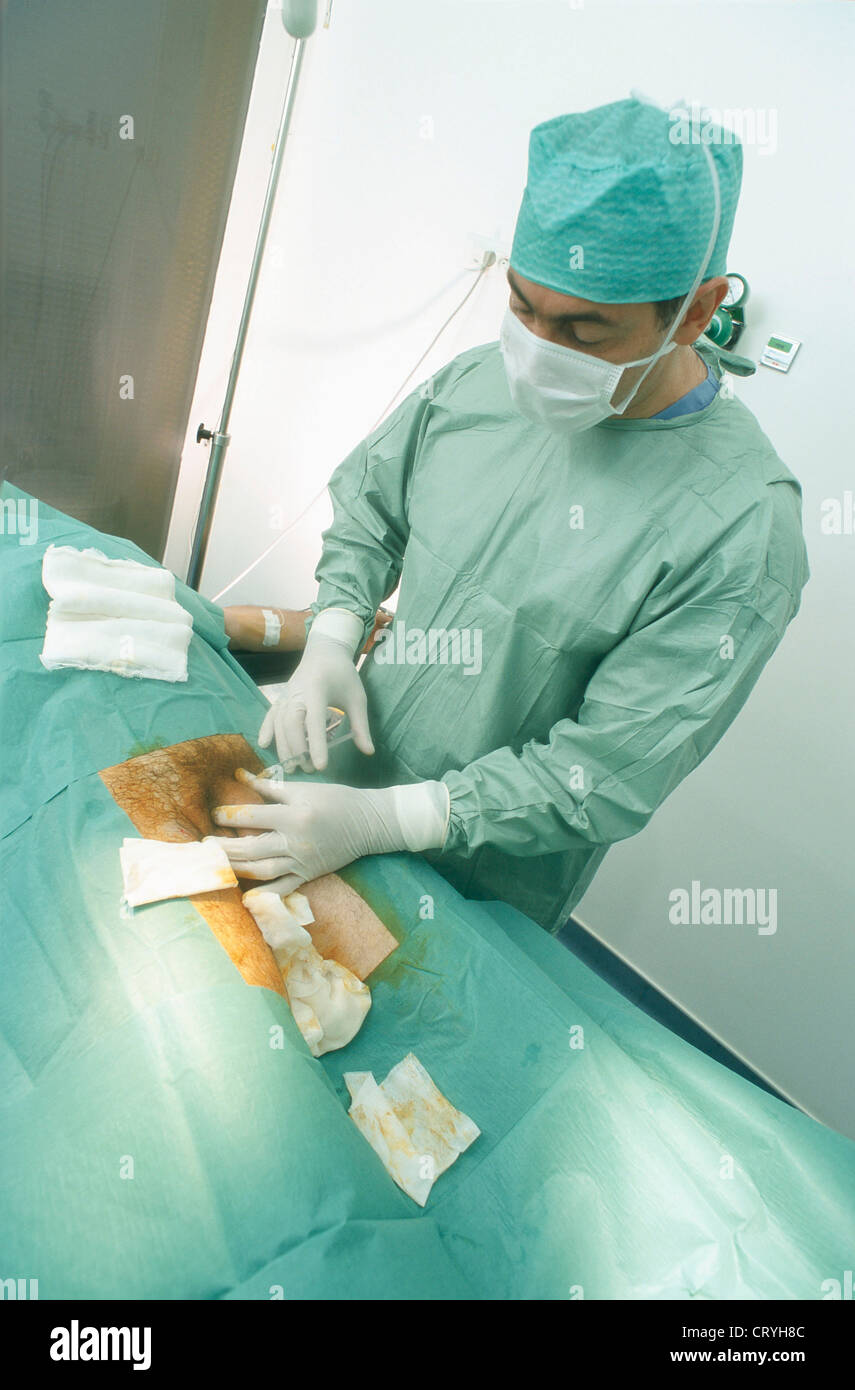 La chirurgie EN PLASTIQUE SUR UN PÉNIS Photo Stock - Alamy