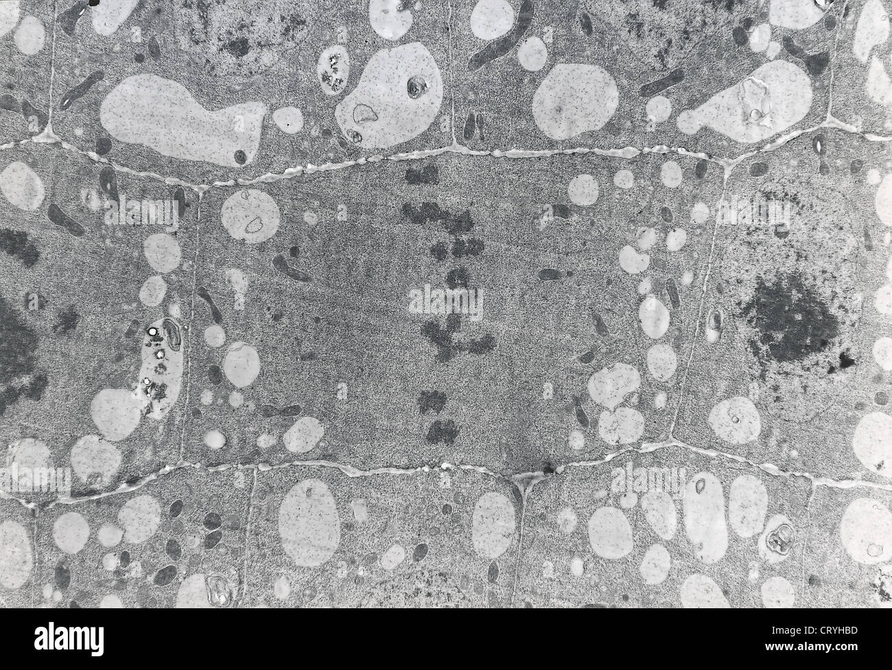 Division cellulaire des plantes mitoses Banque de photographies et d ...
