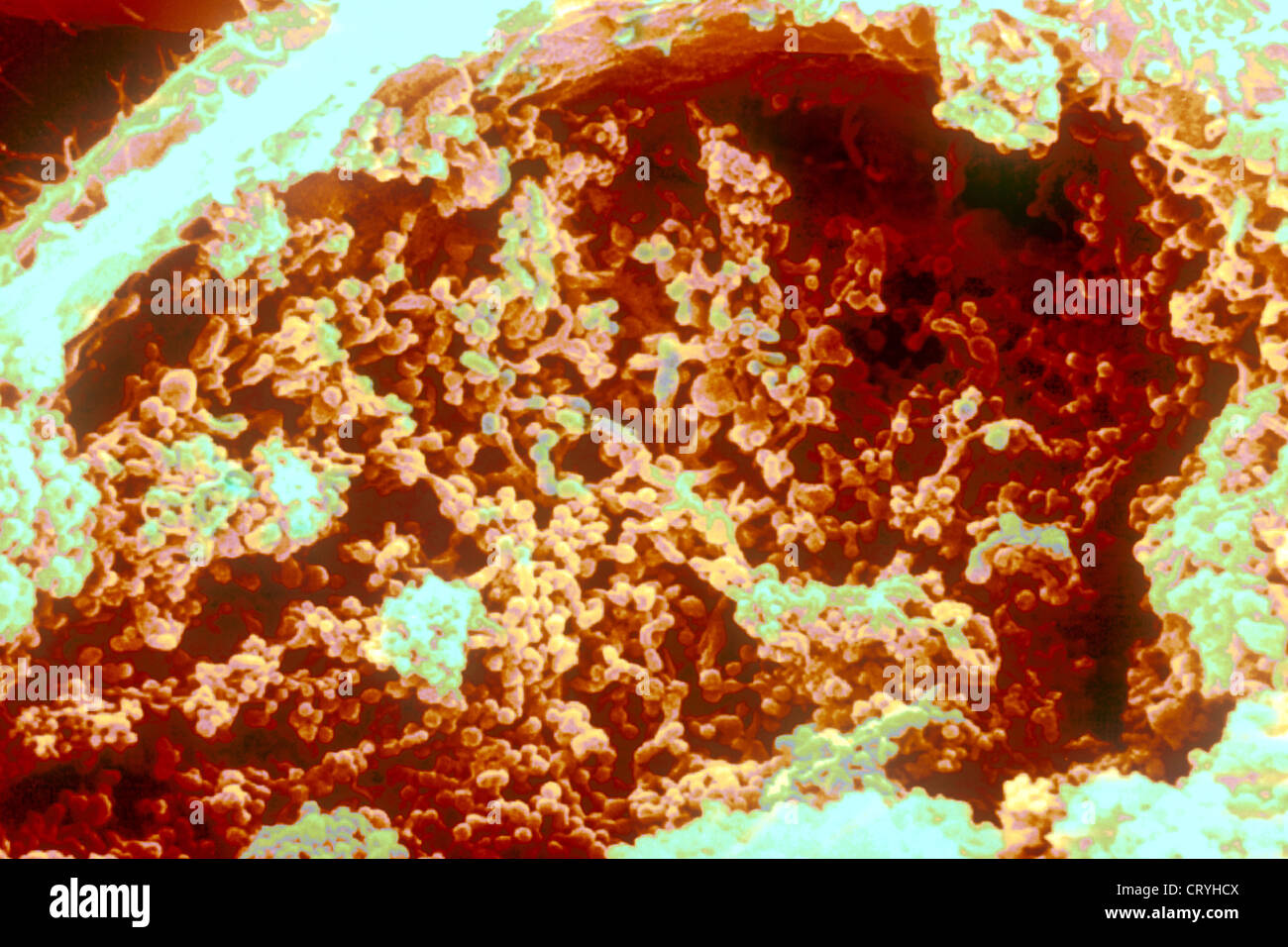 Chlamydia microscope Banque de photographies et d’images à haute ...