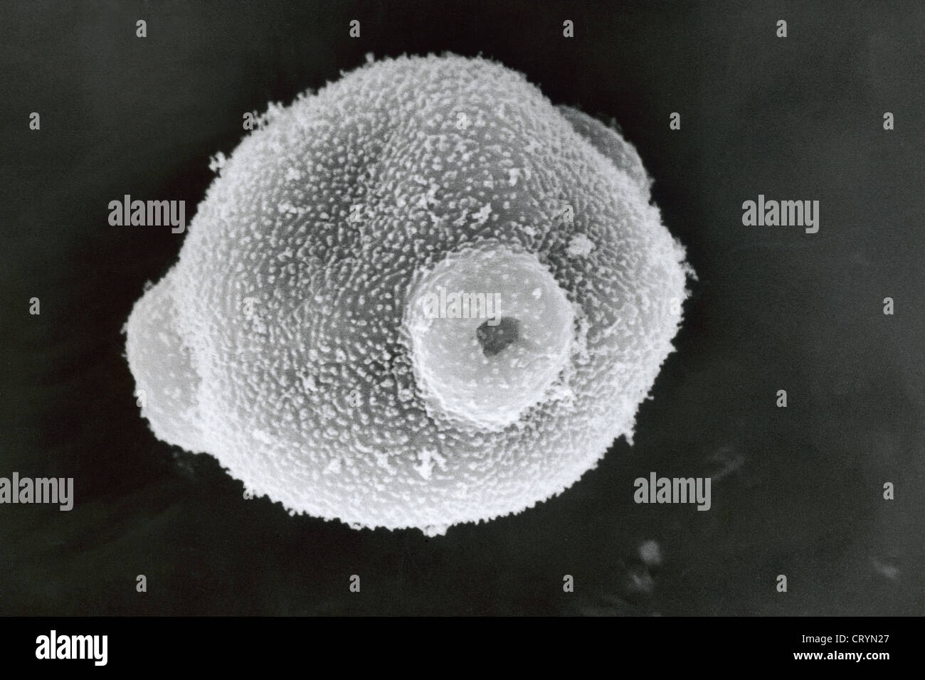 Electron microscope pollen bouleau Banque de photographies et d’images ...