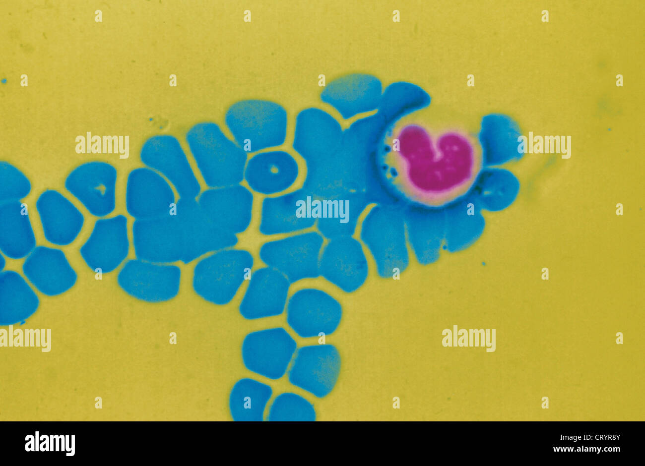 Paludisme micrographie Banque de photographies et d’images à haute ...