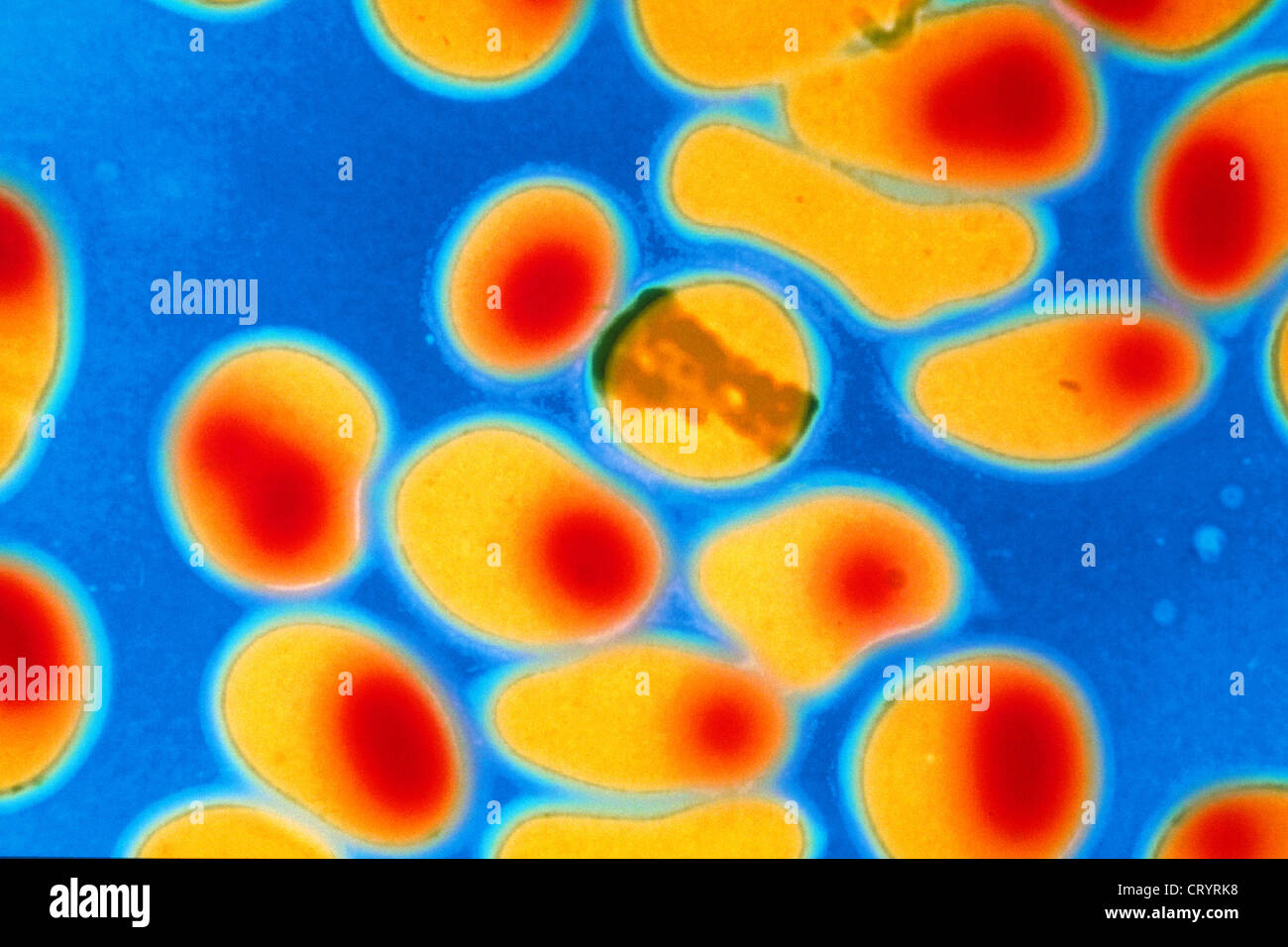 Parasites du paludisme plasmodium Banque de photographies et d’images à ...