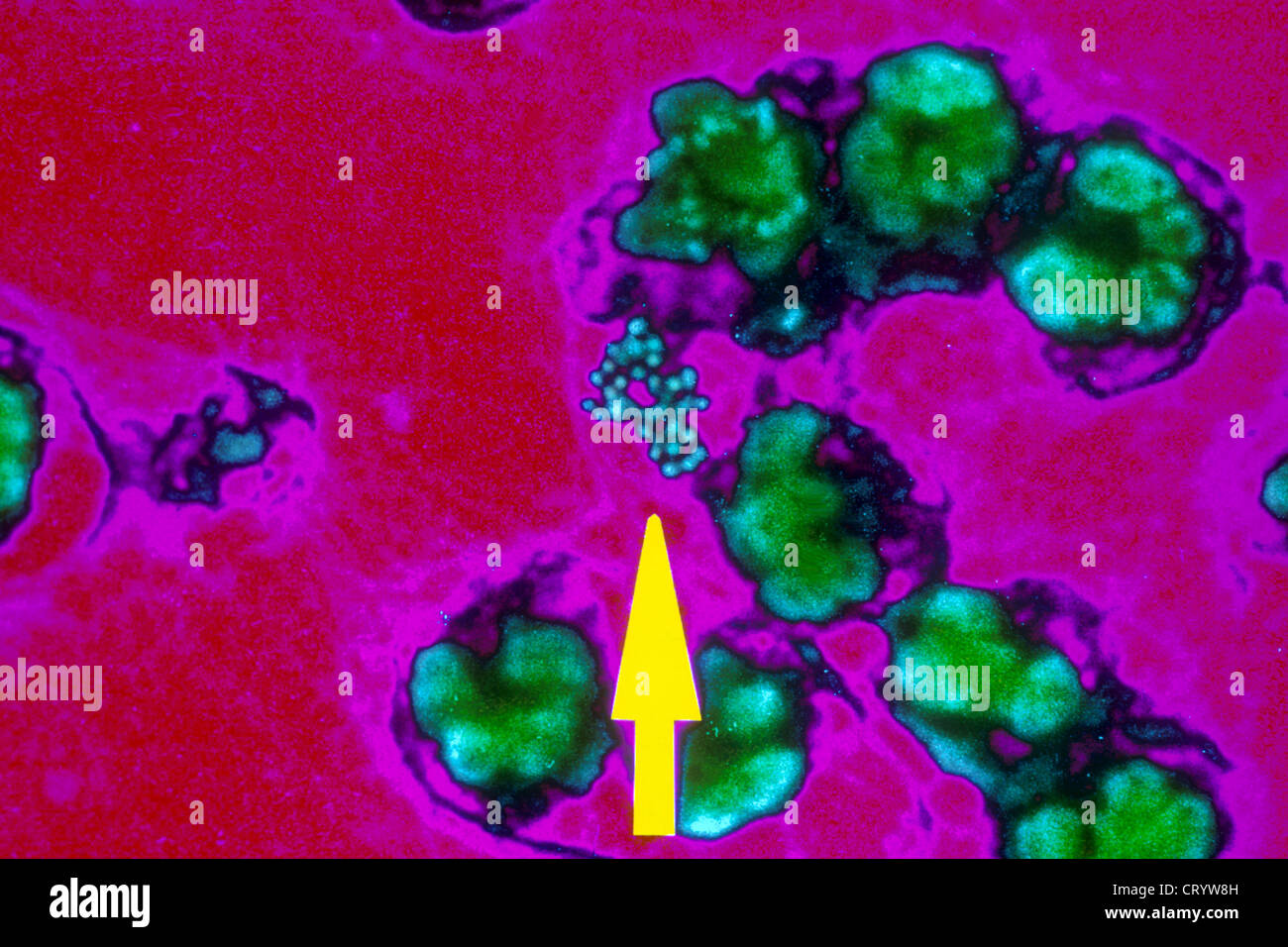 Neisseria meningitidis gram Banque de photographies et d’images à haute ...