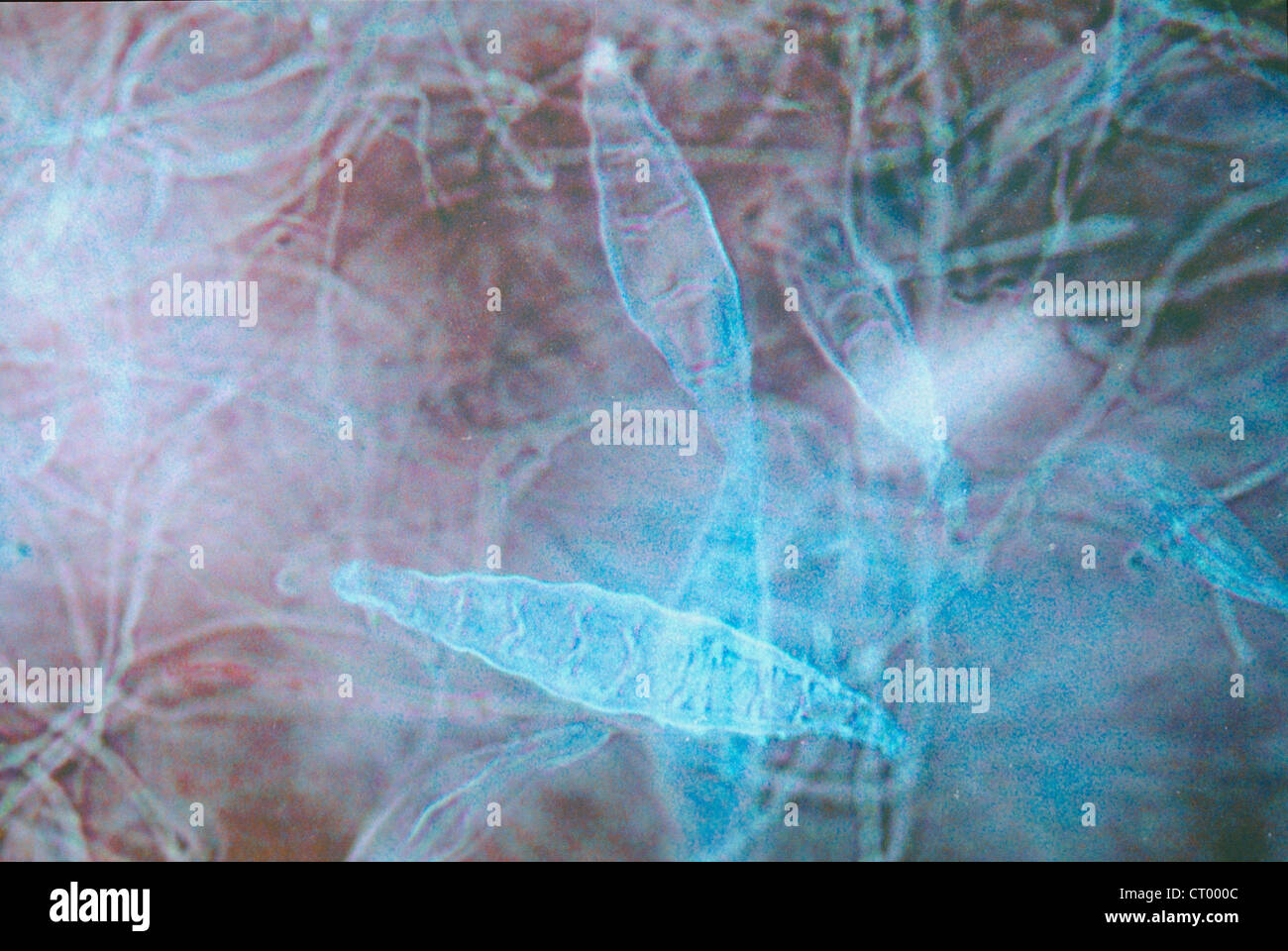 Microsporum fungus Banque de photographies et d’images à haute ...