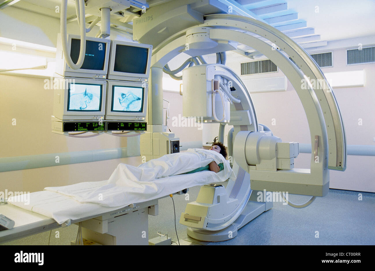 Angiographie cerebrale Banque de photographies et d’images à haute ...