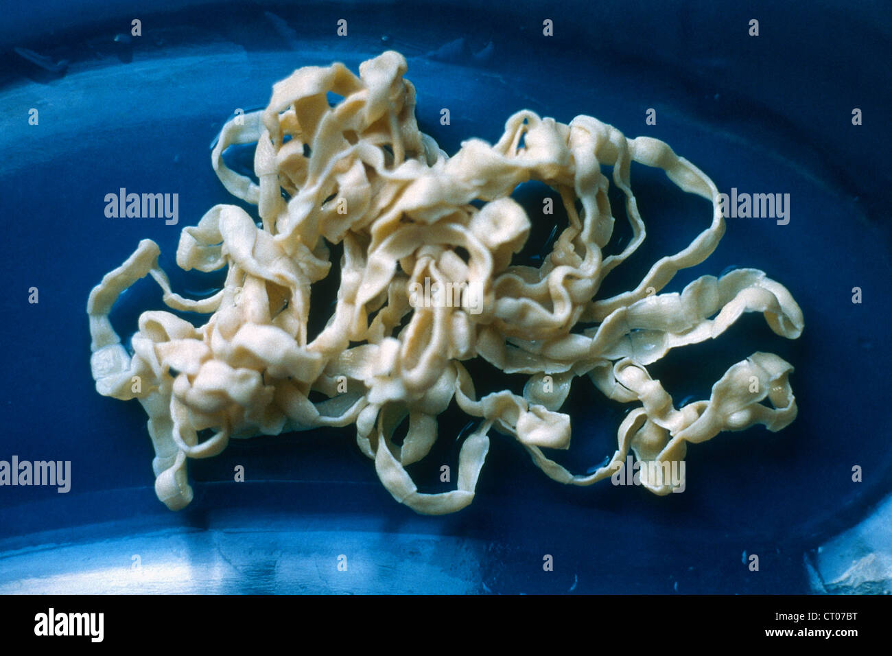 Taenia saginata Banque de photographies et d’images à haute résolution ...